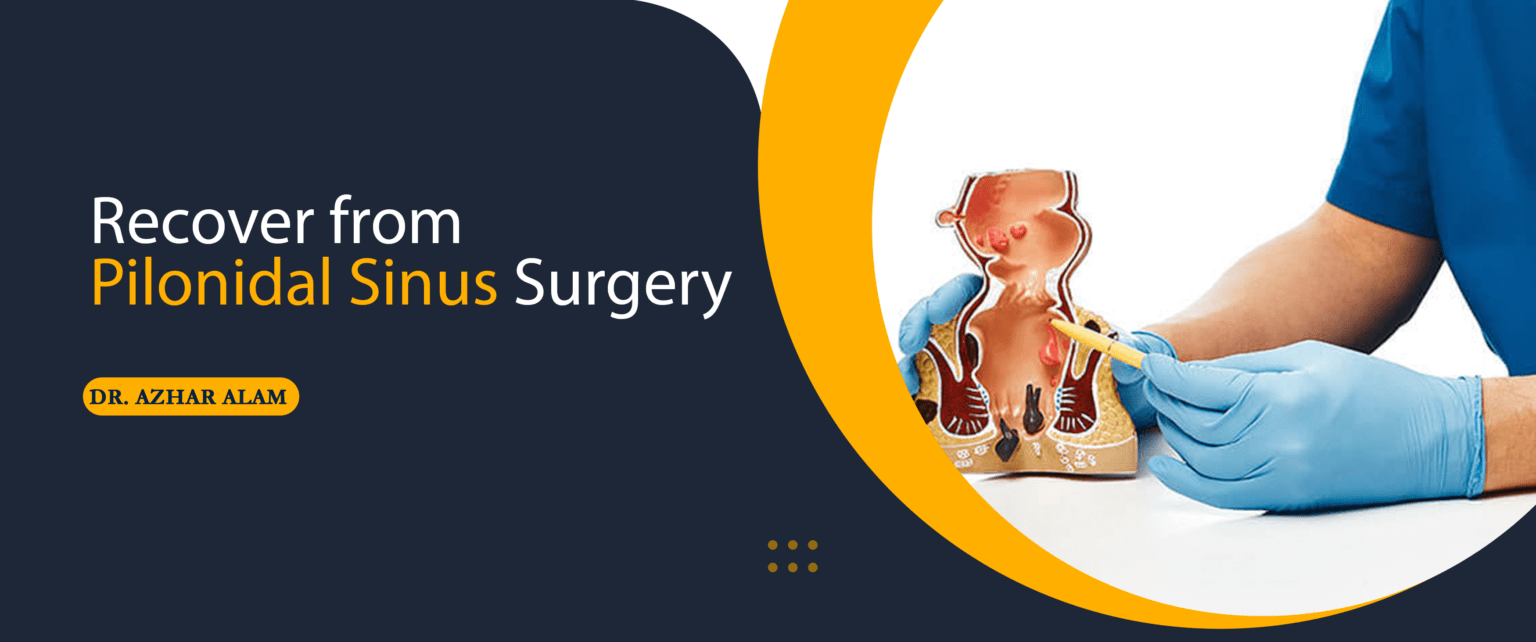 Recover from Pilonidal Sinus Surgery | Pilonidal Sinus Doctor