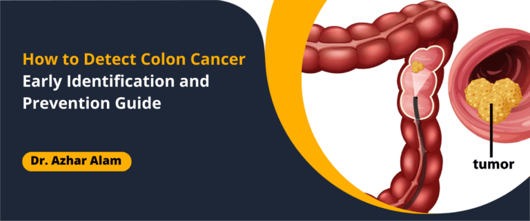 How to Detect Colon Cancer | Dr Azhar Alam